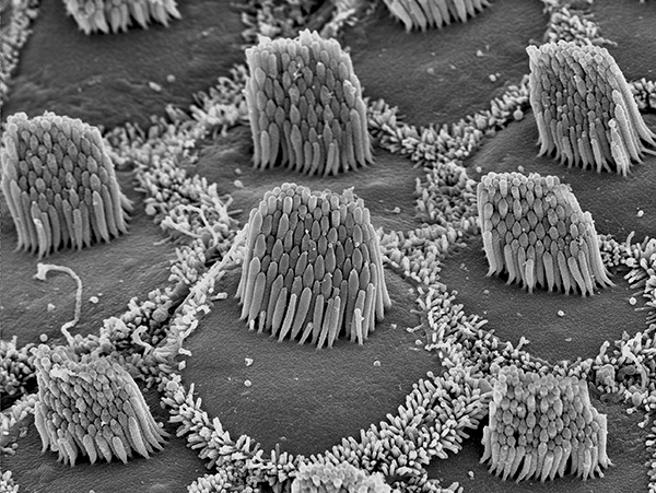 #ScienceSaturday: November 21, 2020 - KIF1A